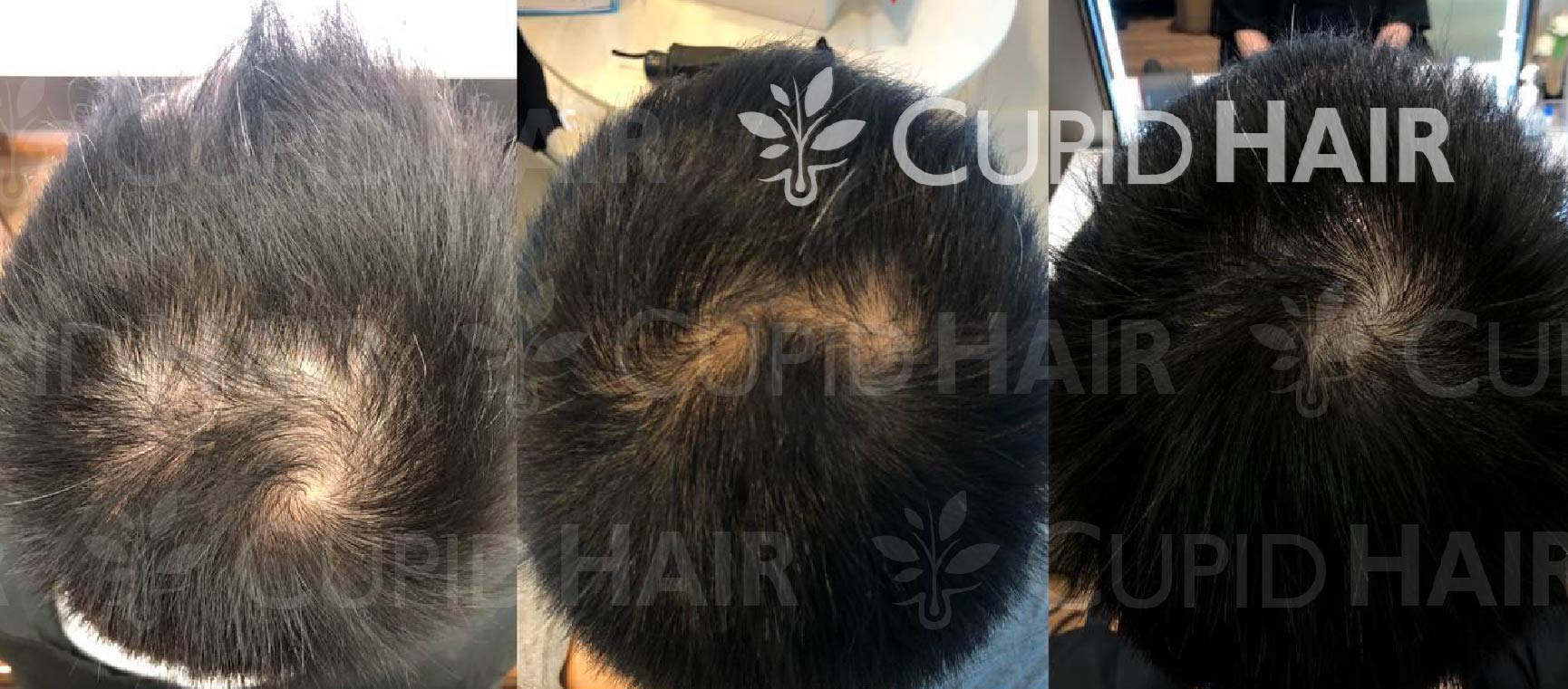 髮比特活髮專家 Cupid Hair (生髮，育髮，防脫髮，頭皮護理，防敏感頭瘡)